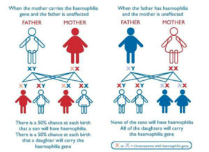 Sex-Linked Inheritance-Haemophilia - W3schools